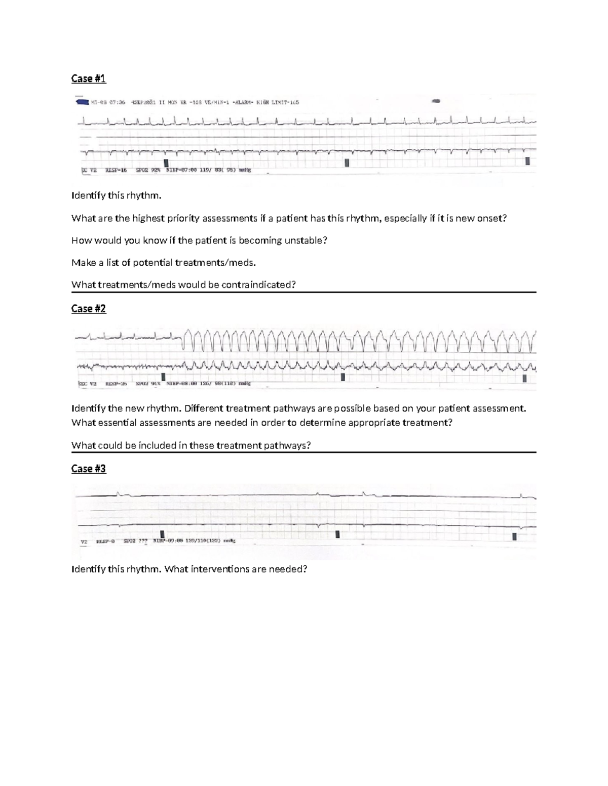 N4870 Dysrhythmia Case Study: Assessments & Treatment Pathways SP24 ...