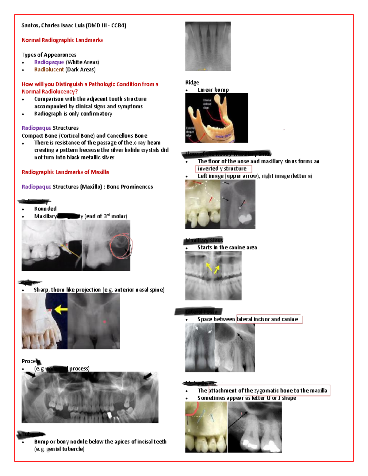 DMD CCB4 Radiographic Landmarks: Distinguishing Normal vs. Pathologic ...