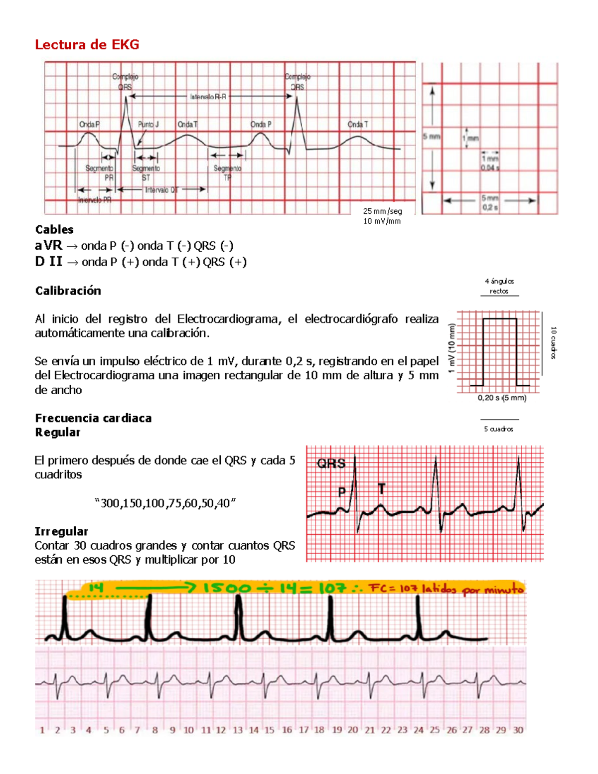 Resumen de EKG - Electrocardiograma - 10 cuadros 4 ángulos rectos ...