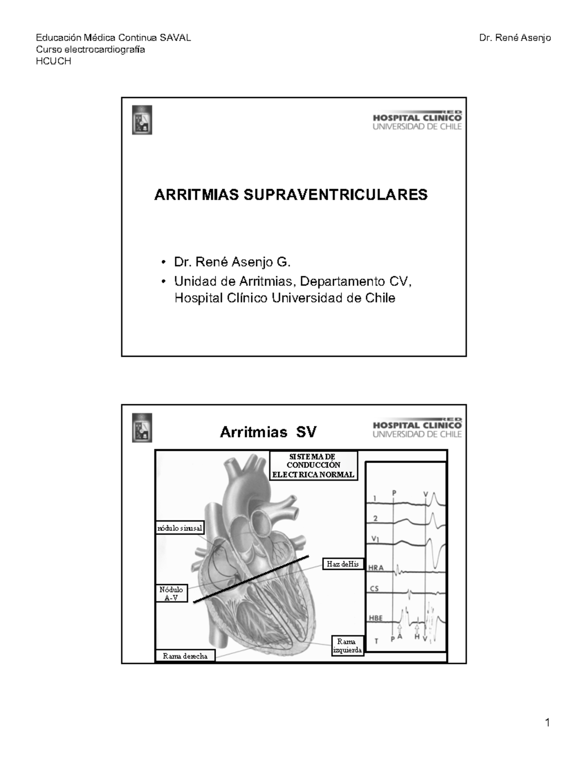 18 009 Hcuch ECG M1 - Curso electrocardiografía Saval - ####### Curso ...