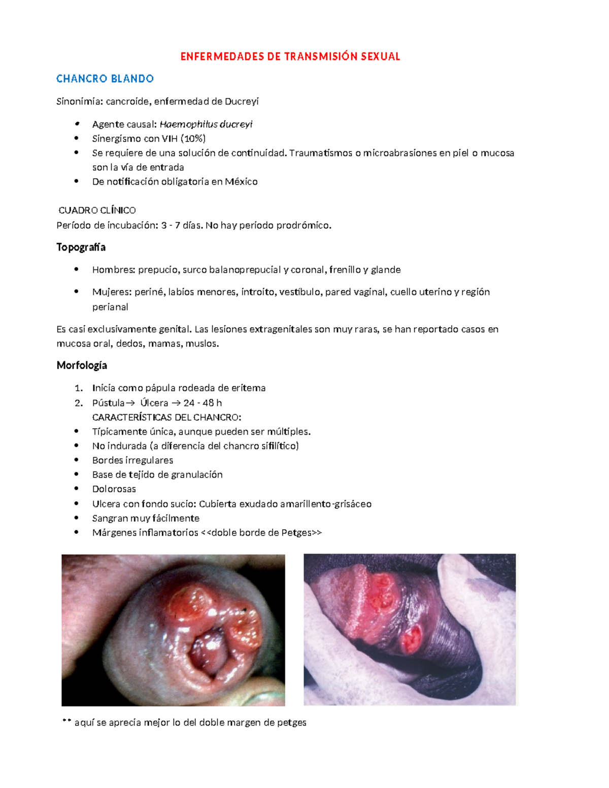 ETS - chancro, LGV, granuloma inguinal, VPH - ENFERMEDADES DE ...