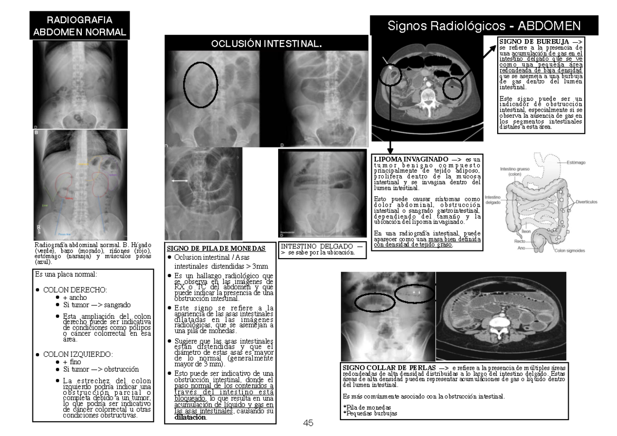 MAPS - Signos Radiológicos del Abdomen en Radiografía - Studocu