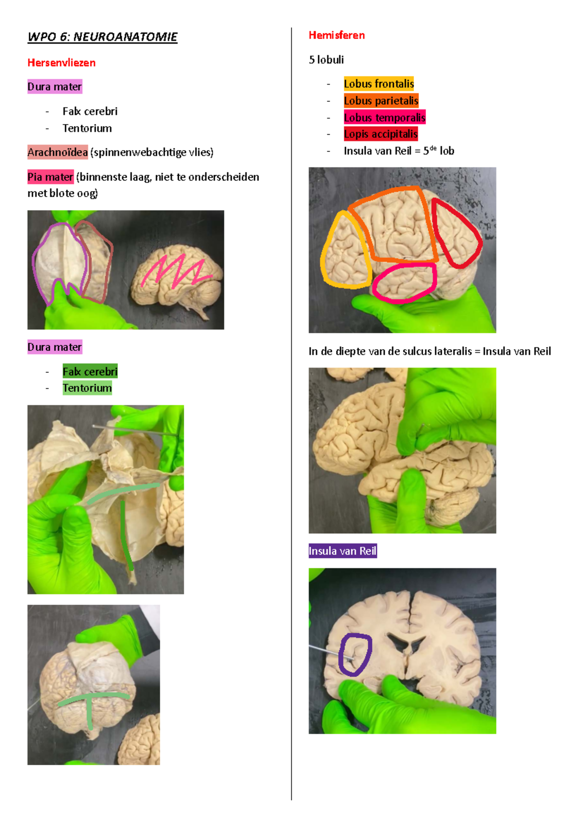 WPO 6: Anatomie Samenvatting van Hemisferen en Hersenvliezen - Studocu