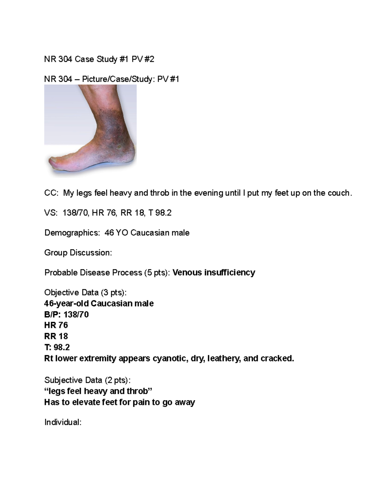 NR 303 case study 1 - NR 304 Case Study #1 PV # NR 304 – Picture/Case/Study: PV # CC: My legs ...