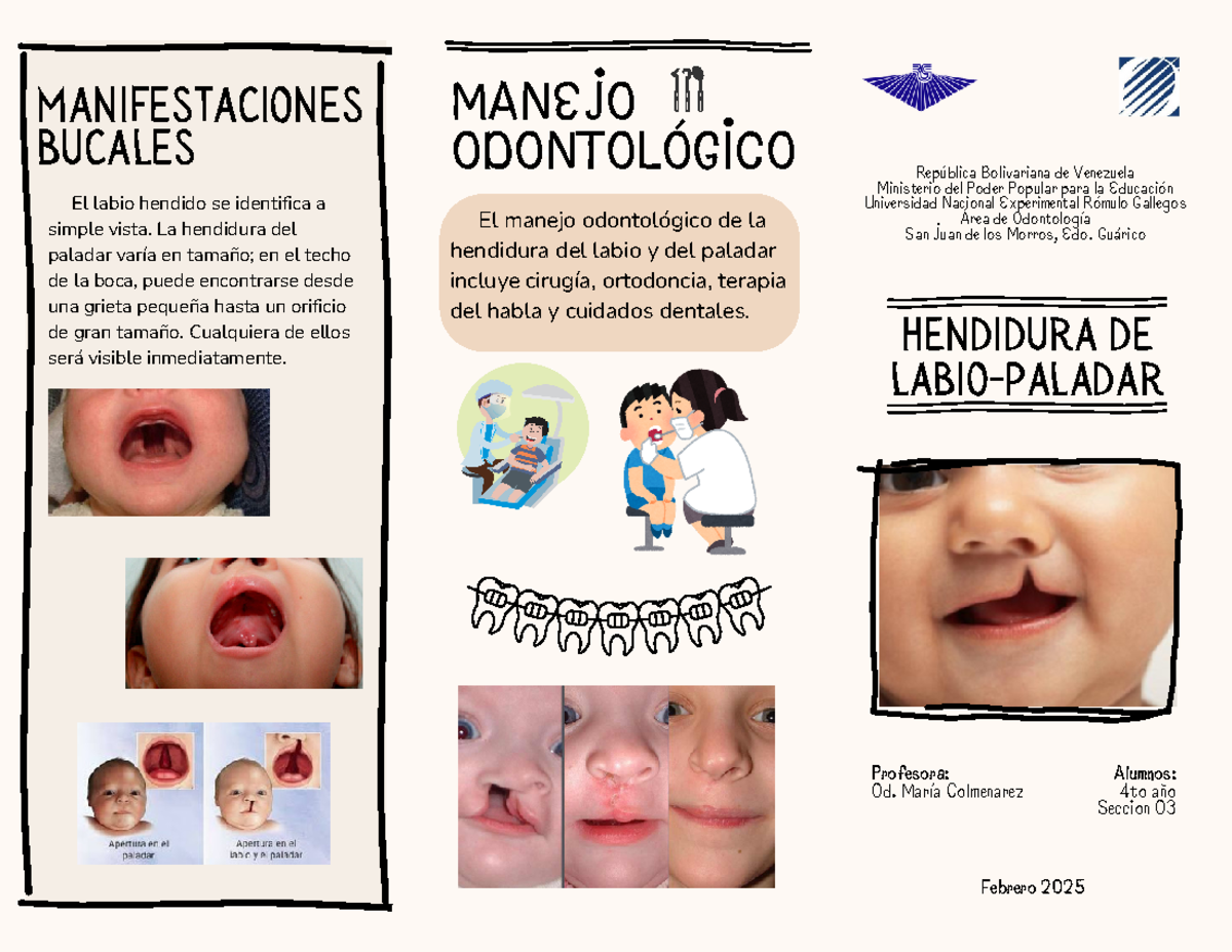 Tríptico hendidura labio-paladar - Hendidura de labio-paladar ...