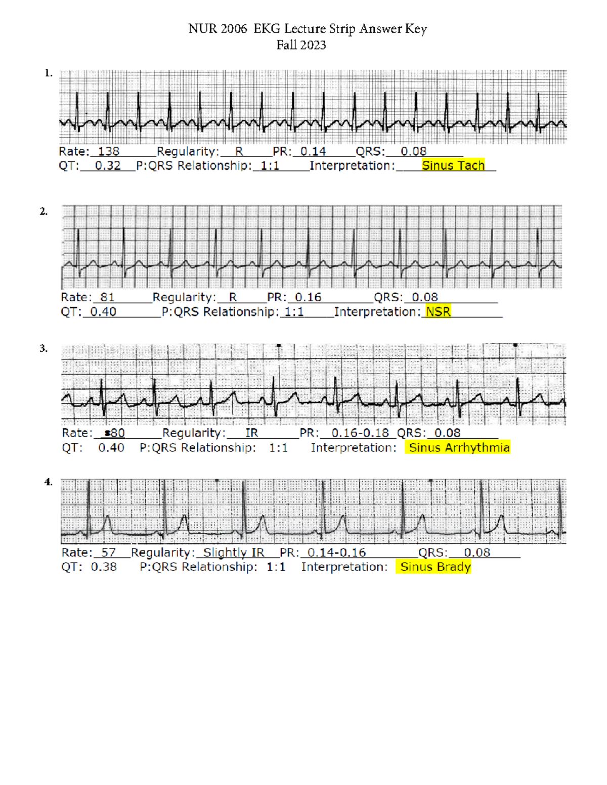 NUR 2006 Lecture EKGs Tele Strip Answer Key - NUR2731C:20883 - 1. 2. 3 ...