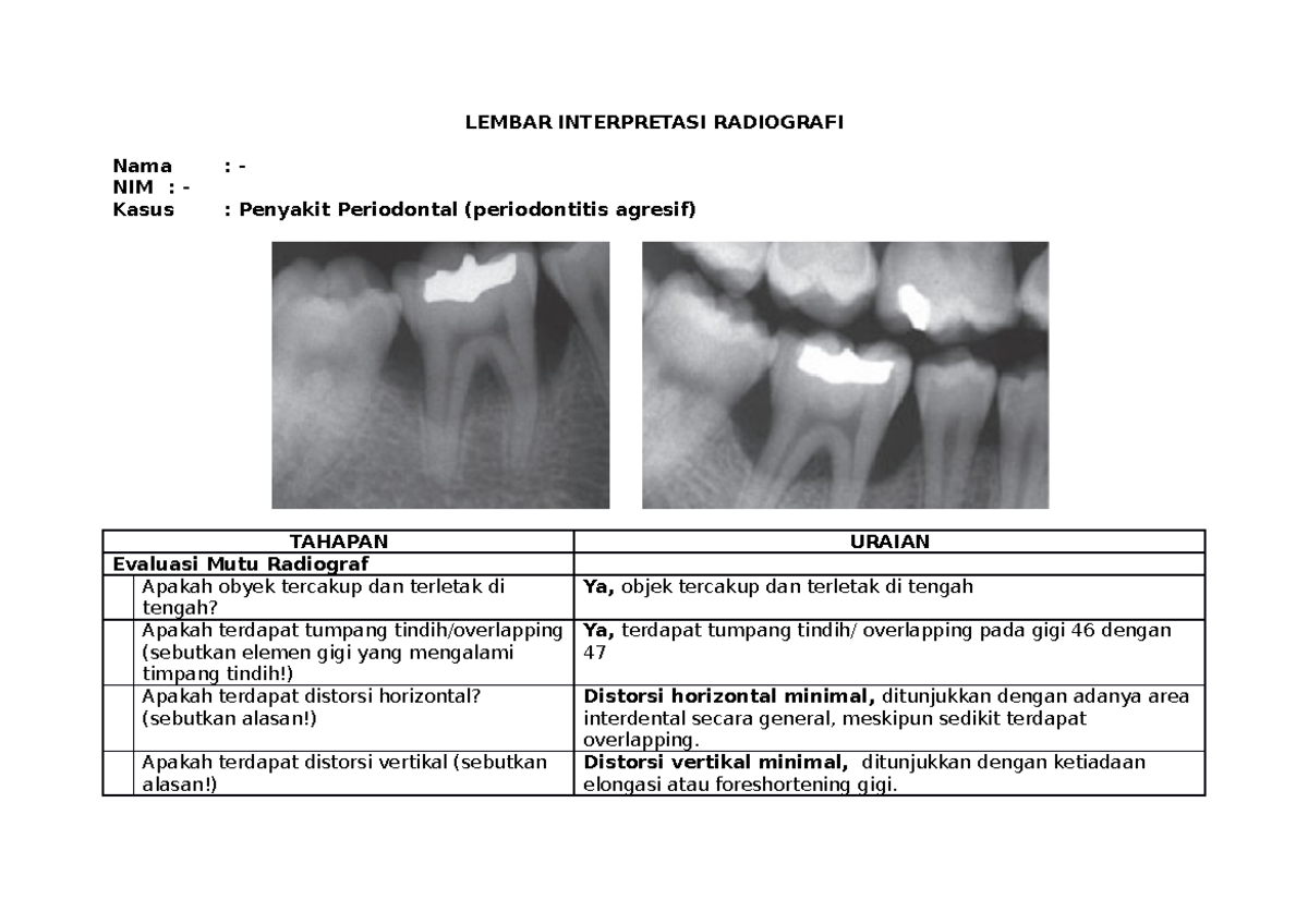 Interpretasi Radiografi Penyakit Periodontal (Peny. Perio) 2 - Studocu