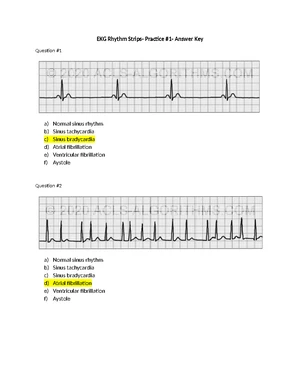 Relias Dysrhythmia Basic A Assessment Test: Key Concepts & EKG Focus ...