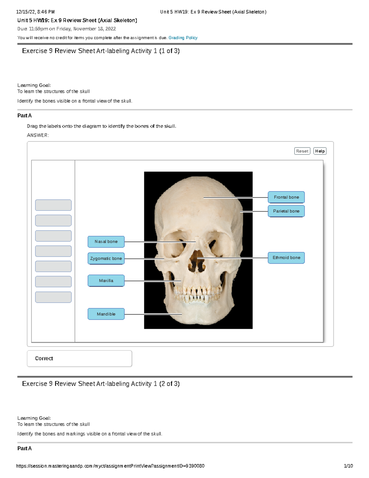 Unit 5 HW19 Ex 9 Review Sheet (Axial Skeleton) - Unit 5 HW19: Ex 9 Review Sheet (Axial Skeleton ...