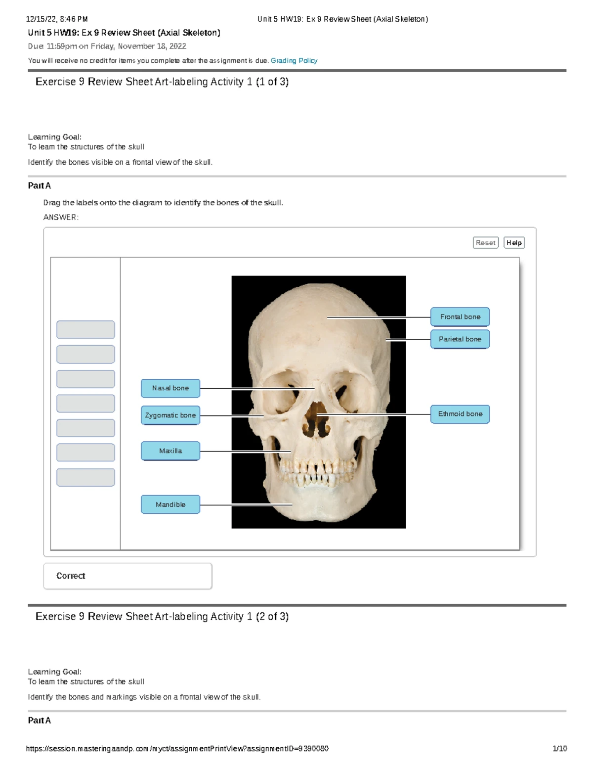 Unit 8 HW26 Ex 15 Review Sheet (Nervous Tissue) - Unit 8 HW26: Ex 15 Review Sheet (Nervous ...