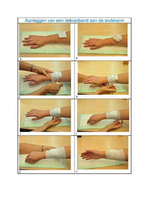 Hechtingen - doktersassistent - 1 Hechtingen 1. Subcutane hechtingen ...