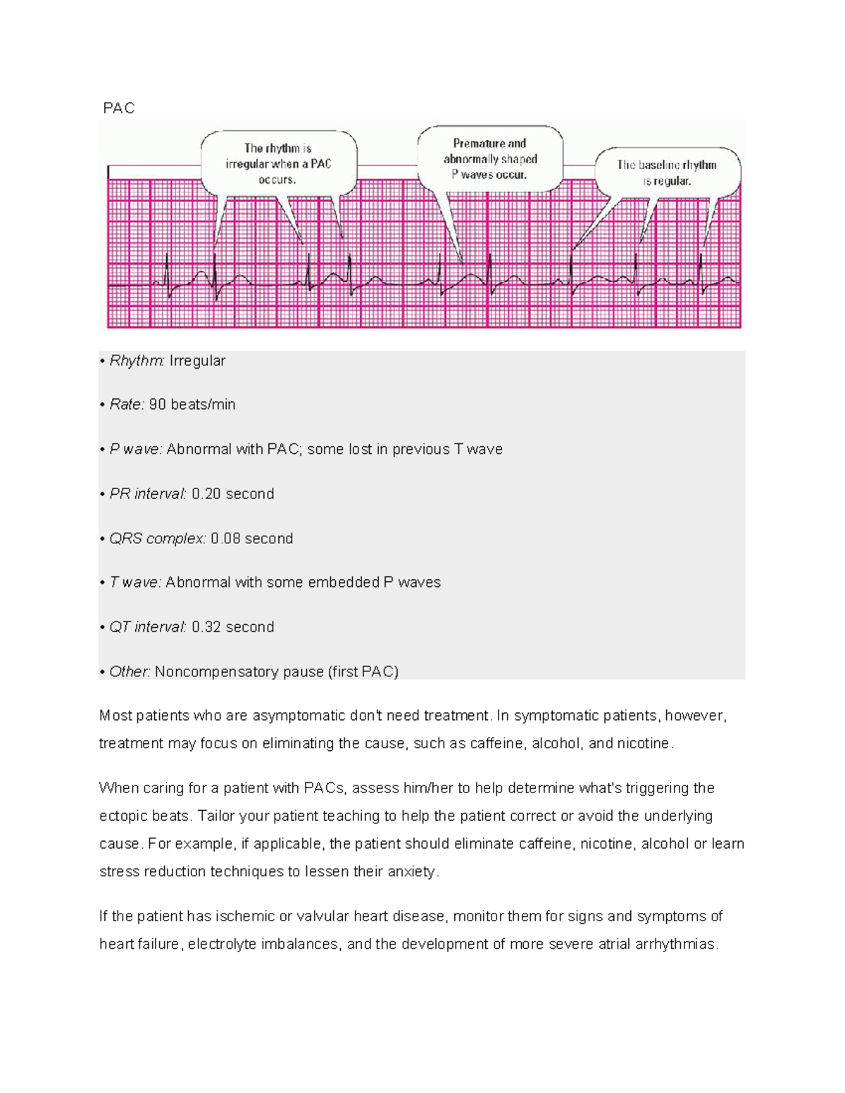 ECG Analysis of Heart Block Strips: PAC, AV Blocks & Treatments - Studocu
