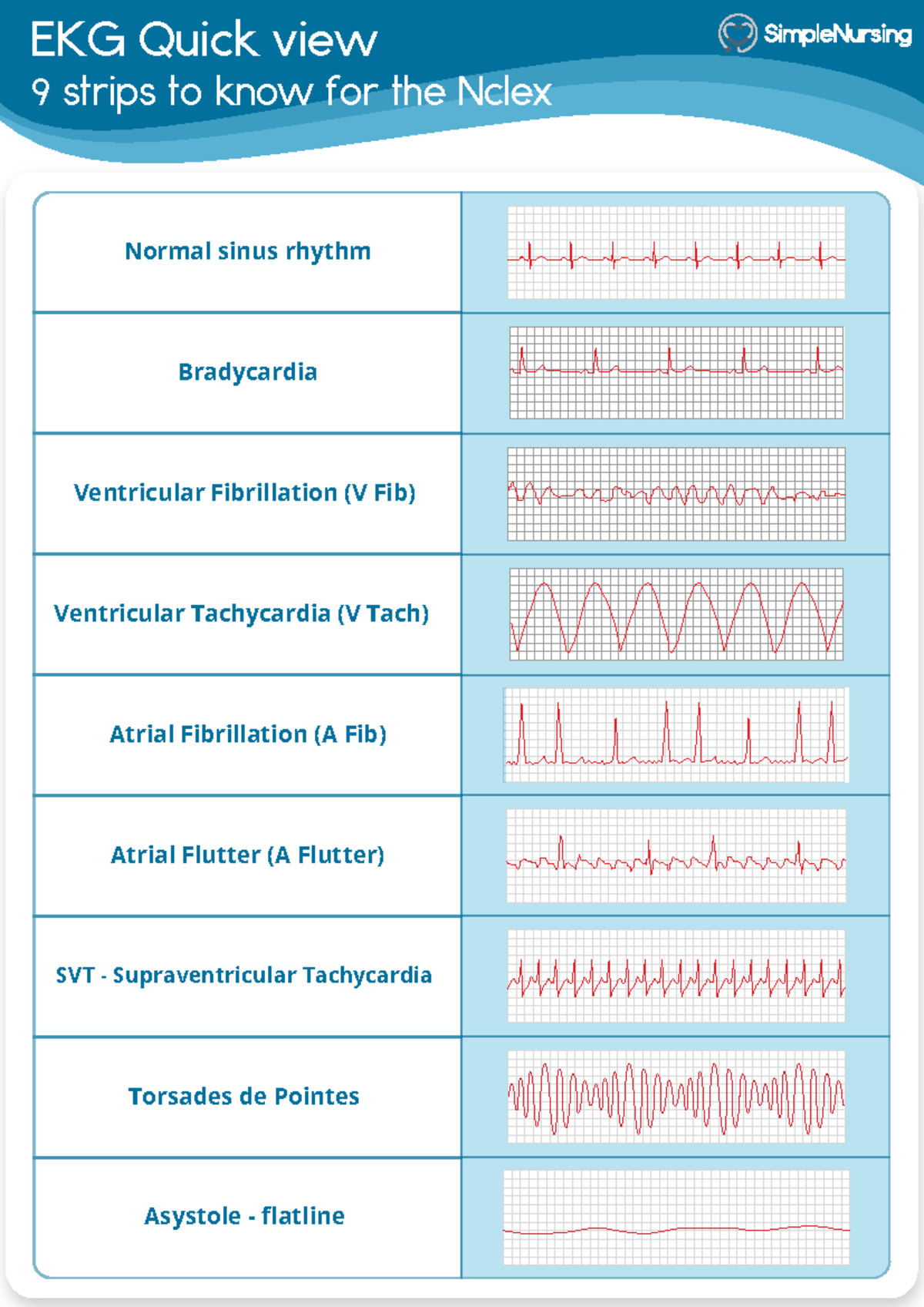 Simple Nursing Study Guide: EKG Strips & Electrolyte Cheat Sheet for ...