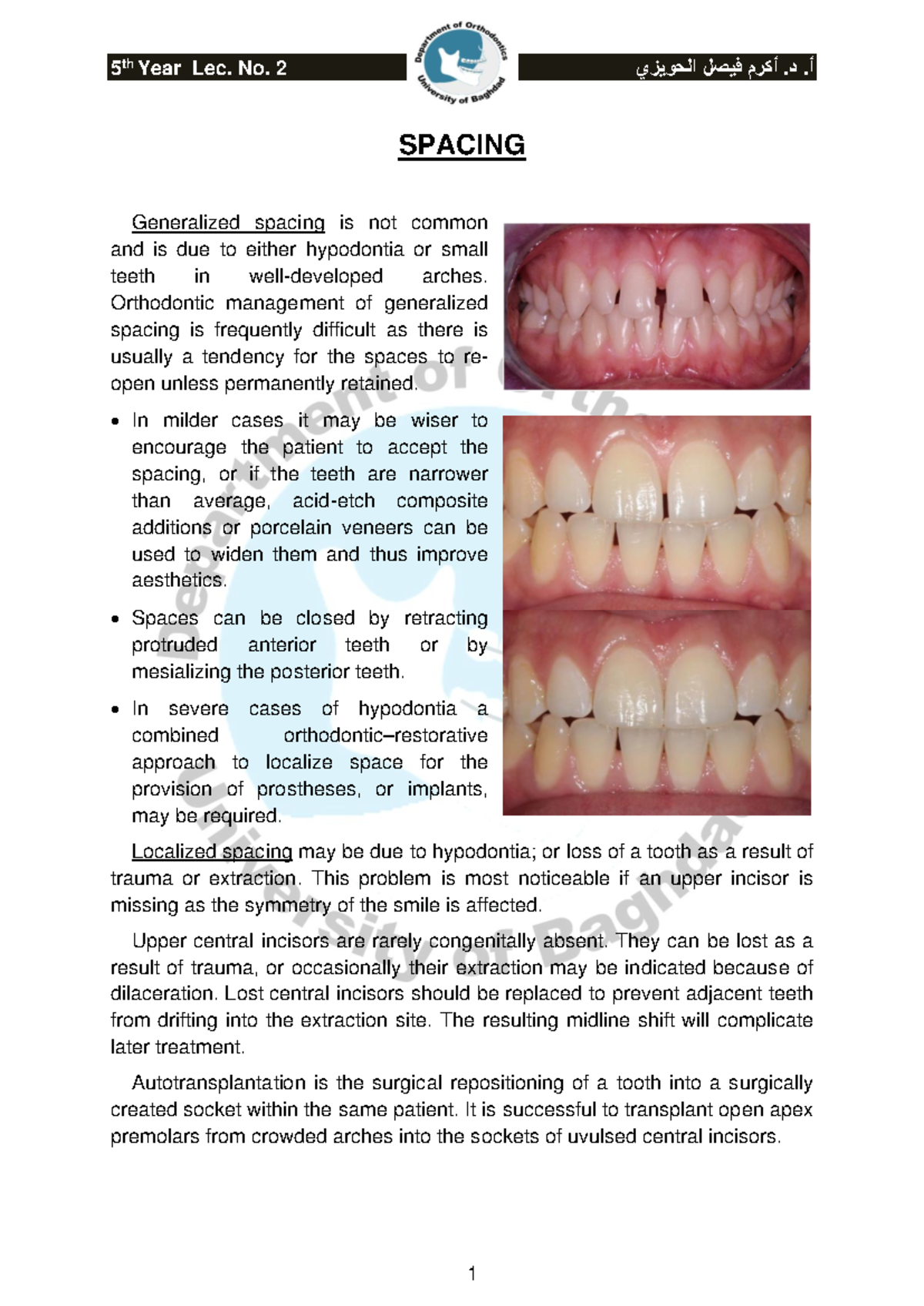 Ortho lec12 - SPACING Generalized spacing is not common and is due to ...