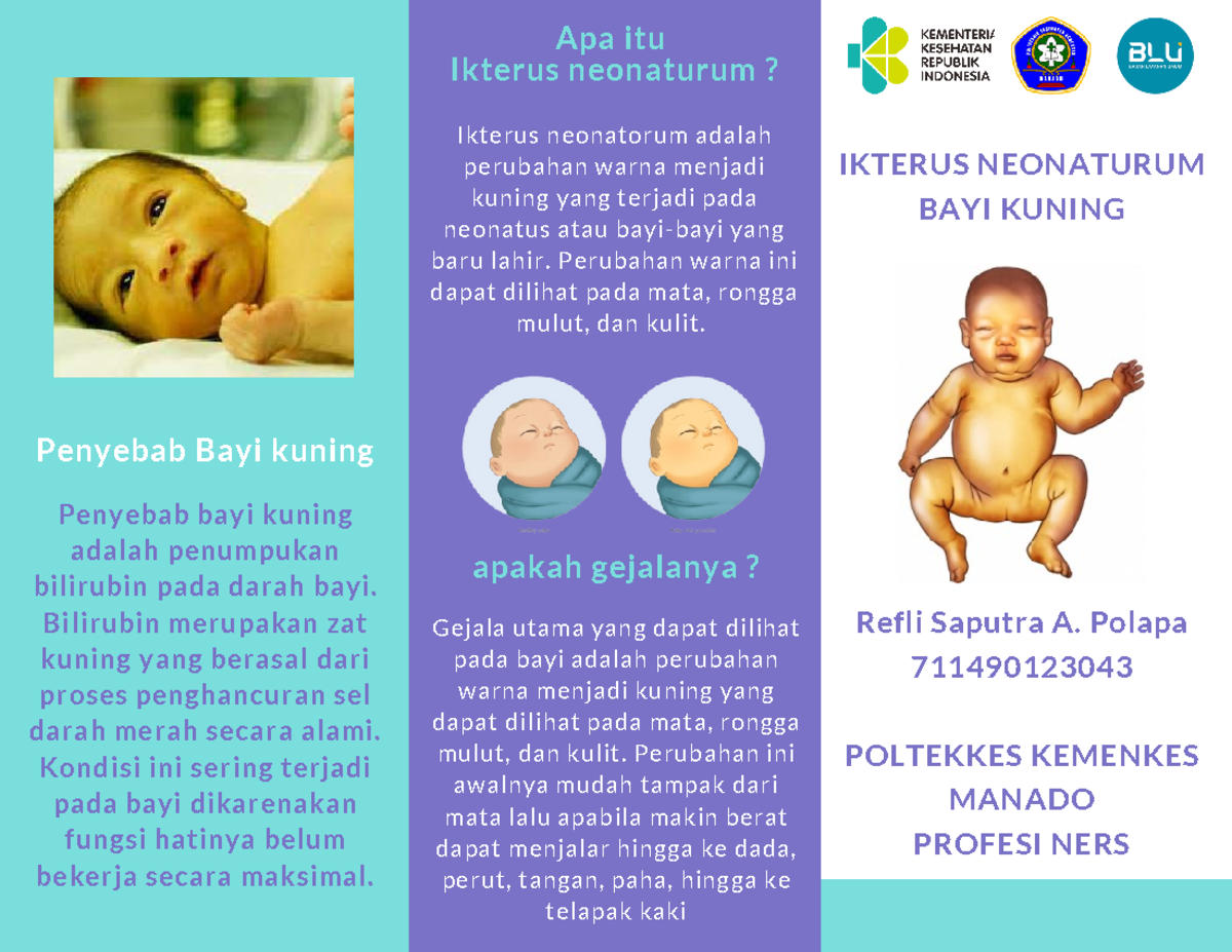 Bayi Kuning: Gejala, Penyebab, dan Penanganan (Ikterus Neonatorum ...