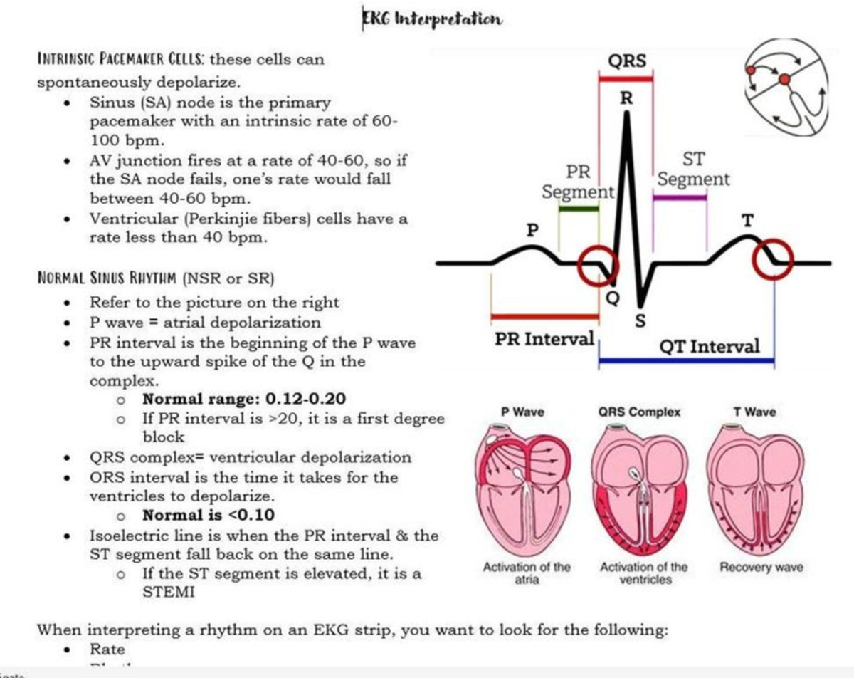 EKG and Hemodynamics, High Acuity - EKG Interpretation INTRINSIC ...