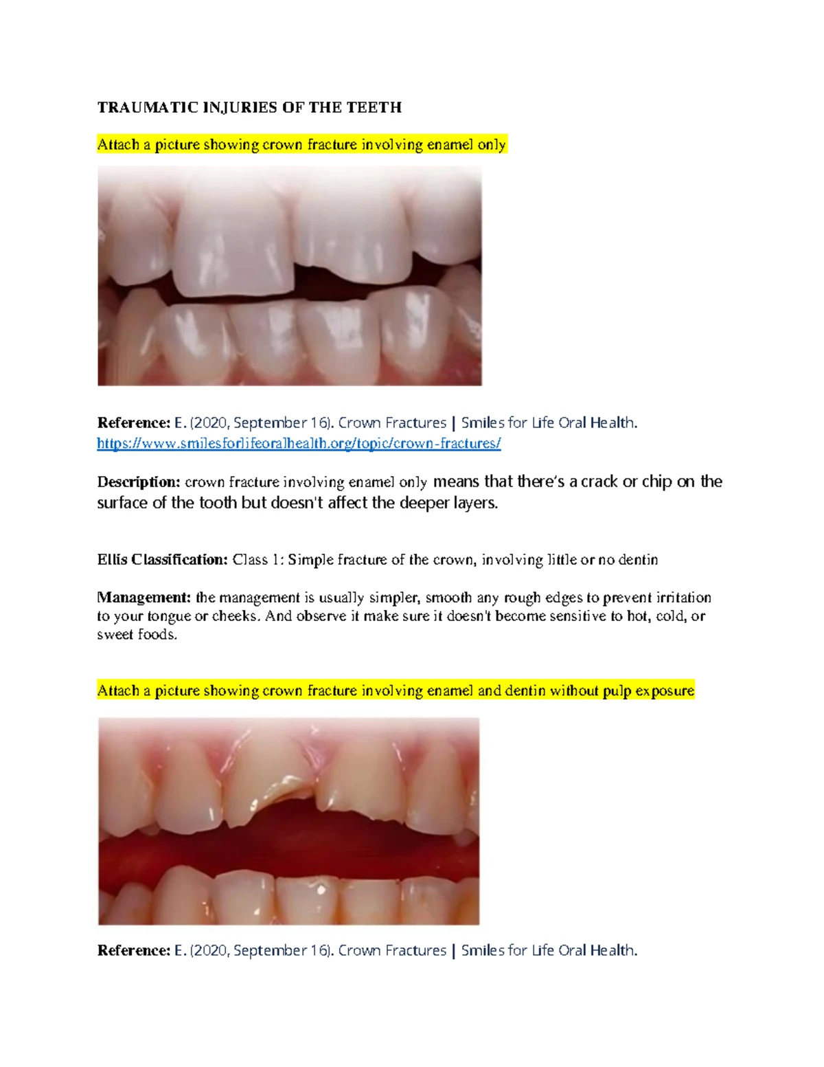 Oral Anatomy Tooth Morphology - TOOTH MORPHOLOGY DIVISION (THIRDS) OF ...