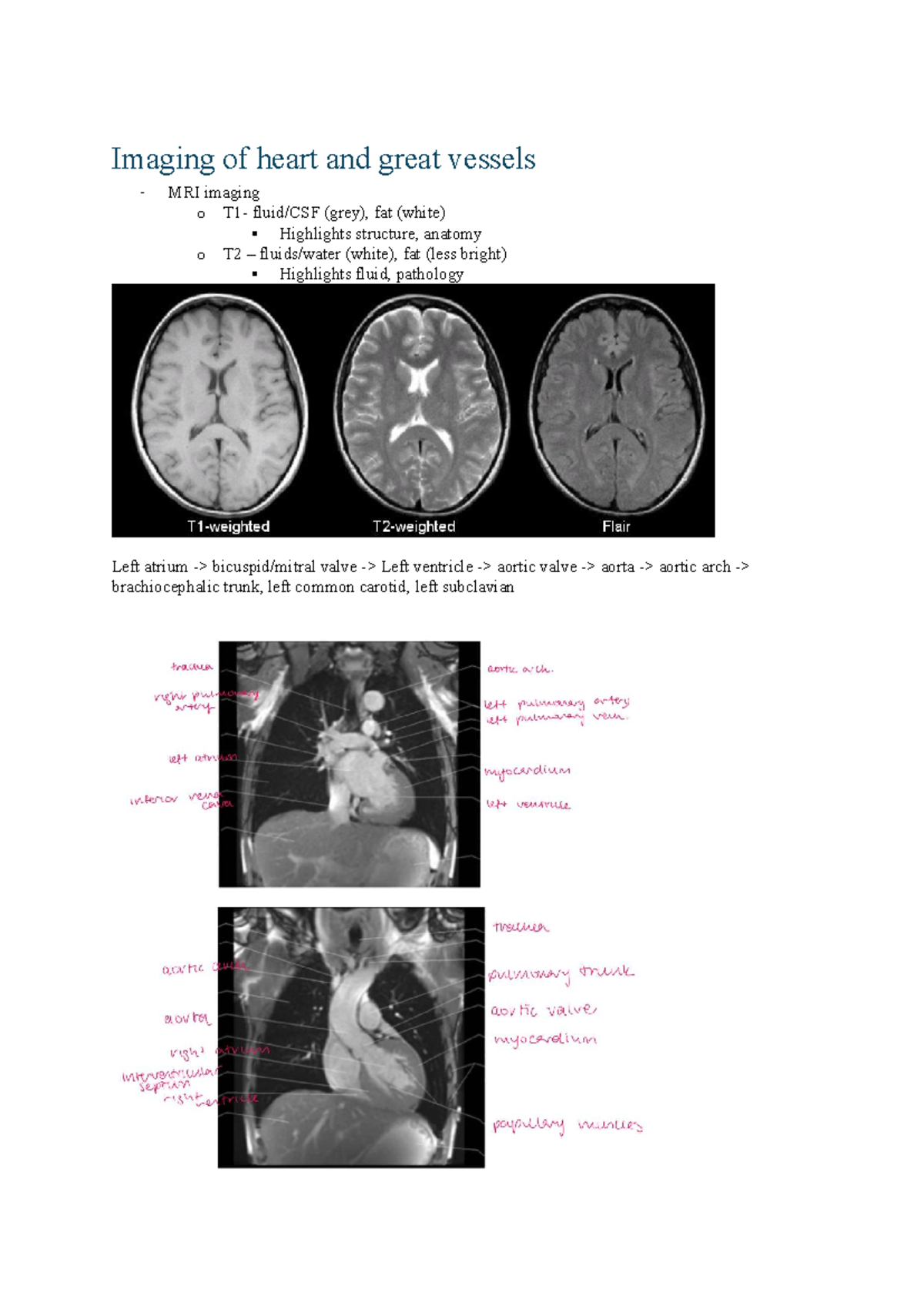 Wk13 Assessment - Imaging Notes for Ultrasound, MRI, X-Ray, CT Exam ...