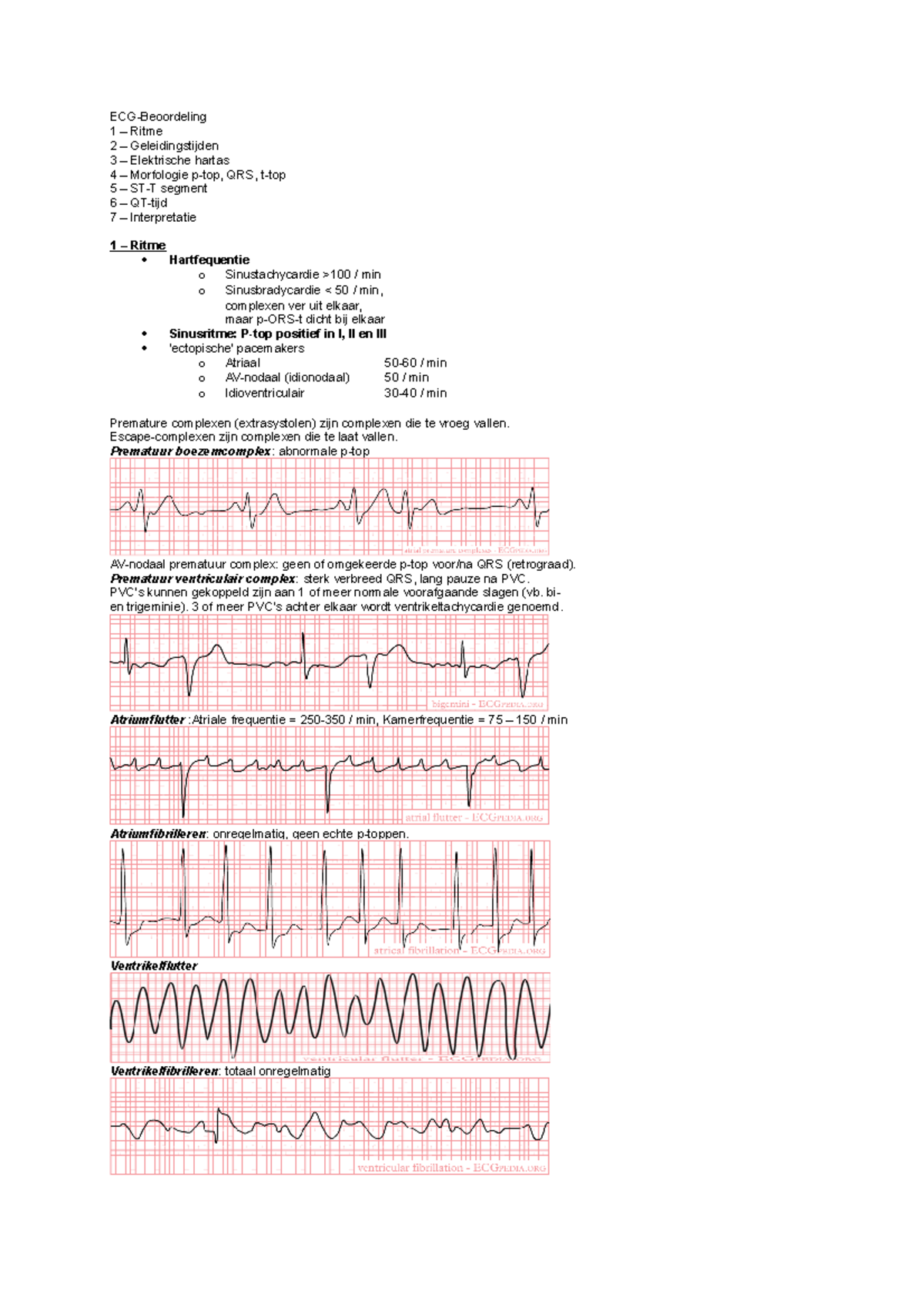 Stappenplan-ECG: Uitleg over ECG-Beoordelingen en Interpretaties ...