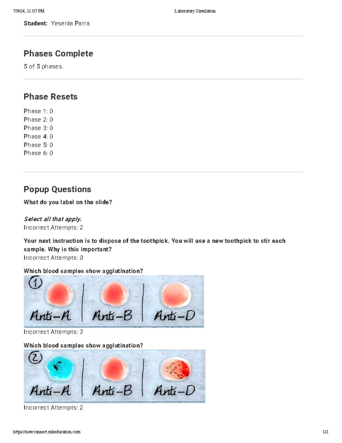 Week 10 Lab 10A Blood Typing - Student: Yesenia Parra Phases Complete 5 ...