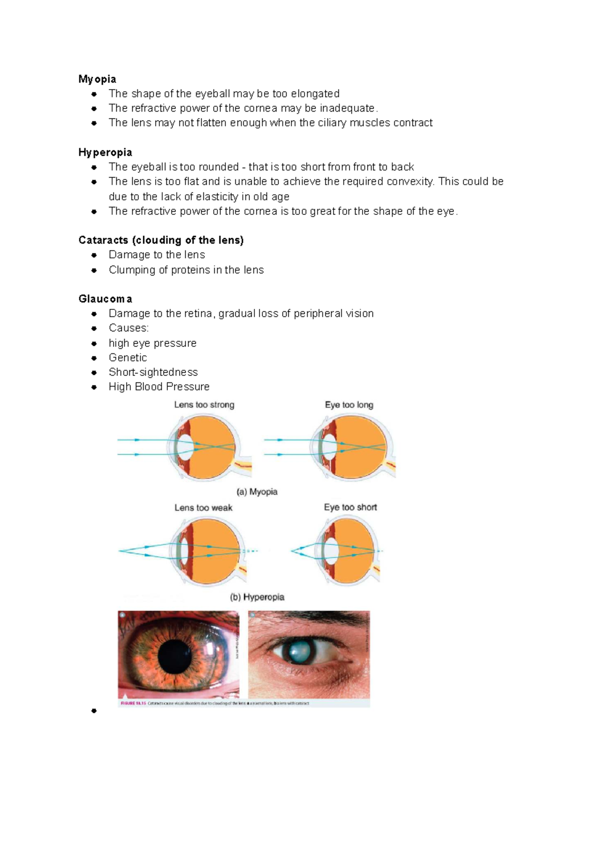 Eye Info Bio: Vision, Hearing, and Kidney Function Explained - Studocu