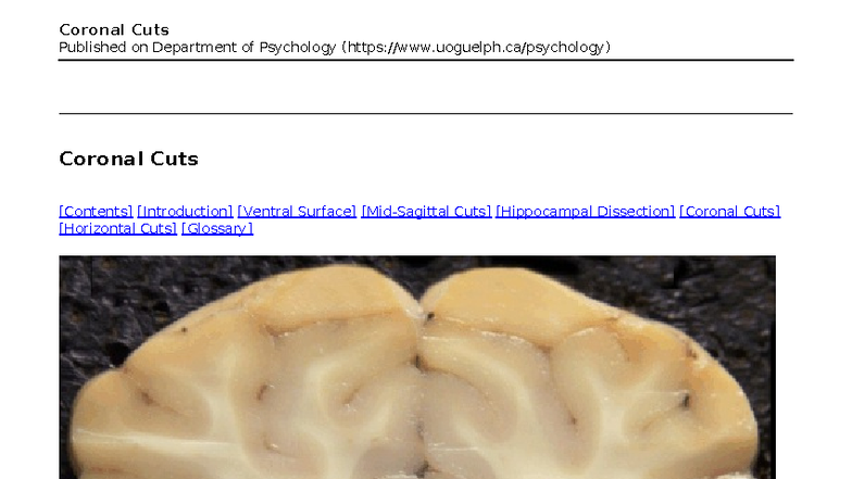 Coronal Cuts & Brain Structure ID Lab Manual - Psychology 101 - Studocu