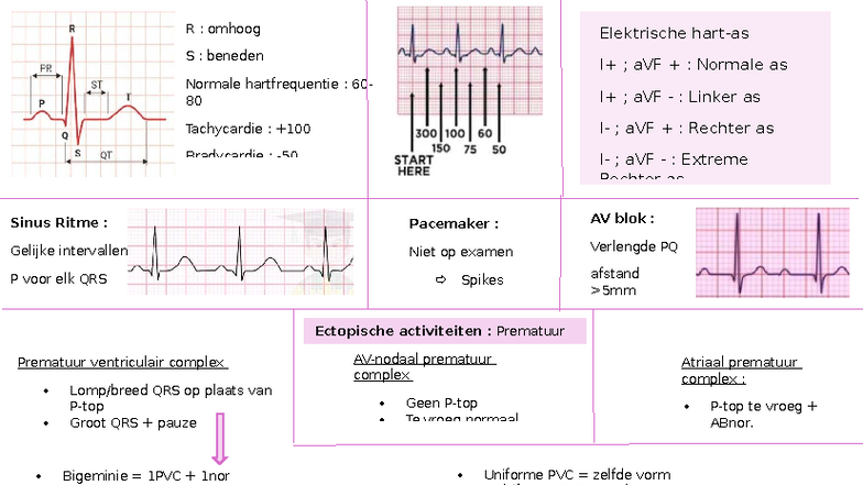 Spiekbrief ECG Zelf Maken: Analyse en Interpretatie - Studocu