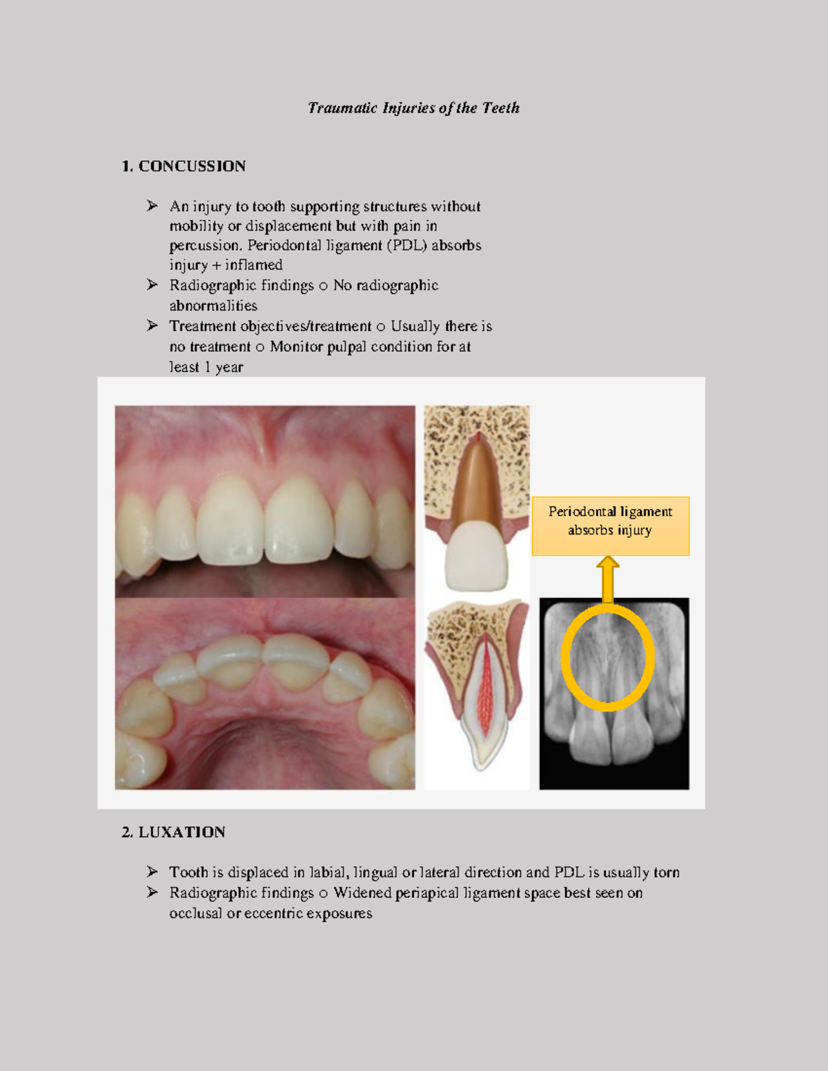 Traumatic Injuries of Teeth - CONCUSSION An injury to tooth supporting ...