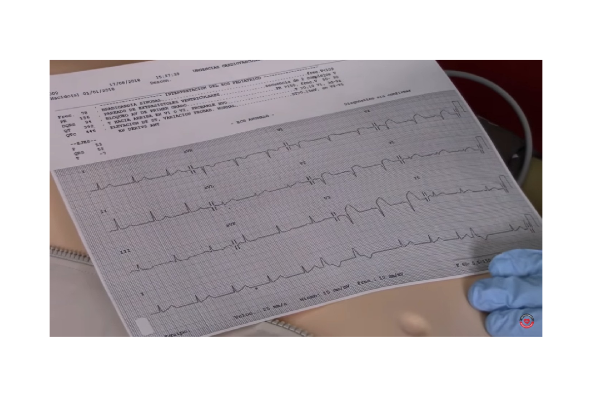 Interpretación del ECG Pediátrico - Curso 000 Hacido 2018 - Studocu