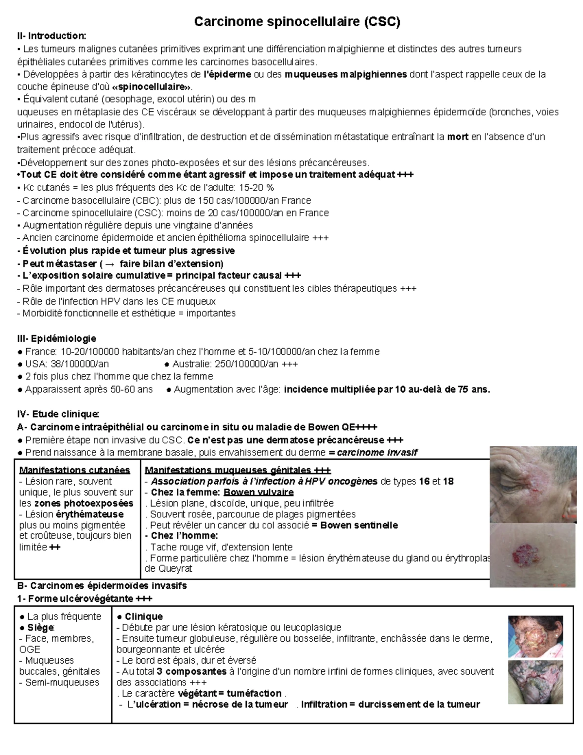 CBC - carcinome basocellulaire - Carcinome basocellulaire (CBC) QE ...