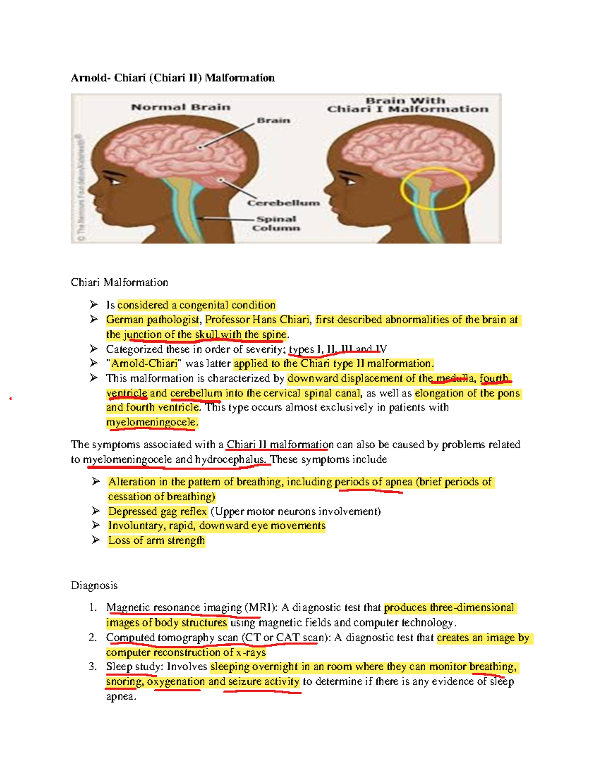 Final Exam: Chiari Malformation & Cerebral Palsy Overview (NRS 101 ...