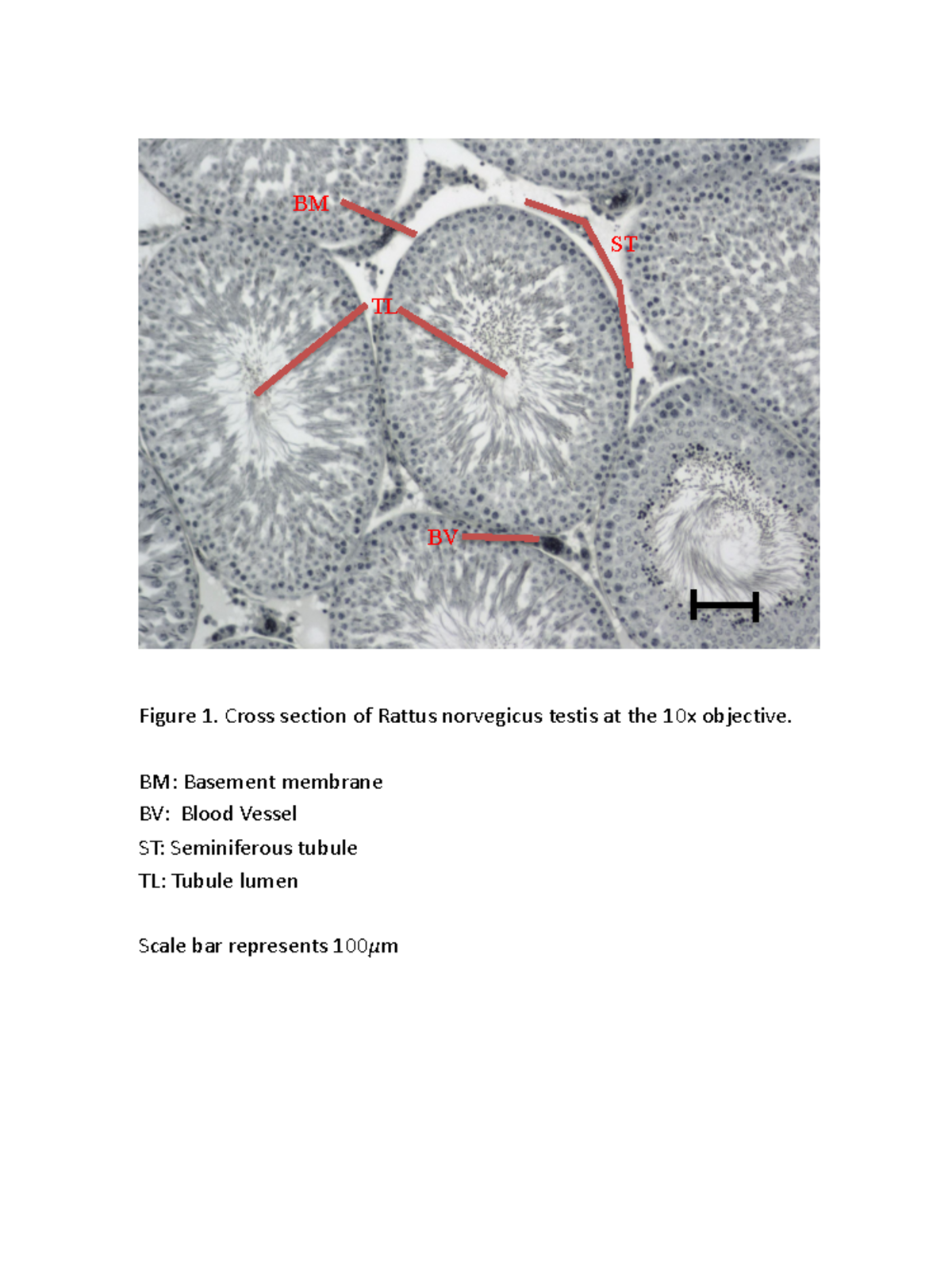Rat testicle 10x-lab3 - Bio Lab report - BIO1130 - Figure 1. Cross ...
