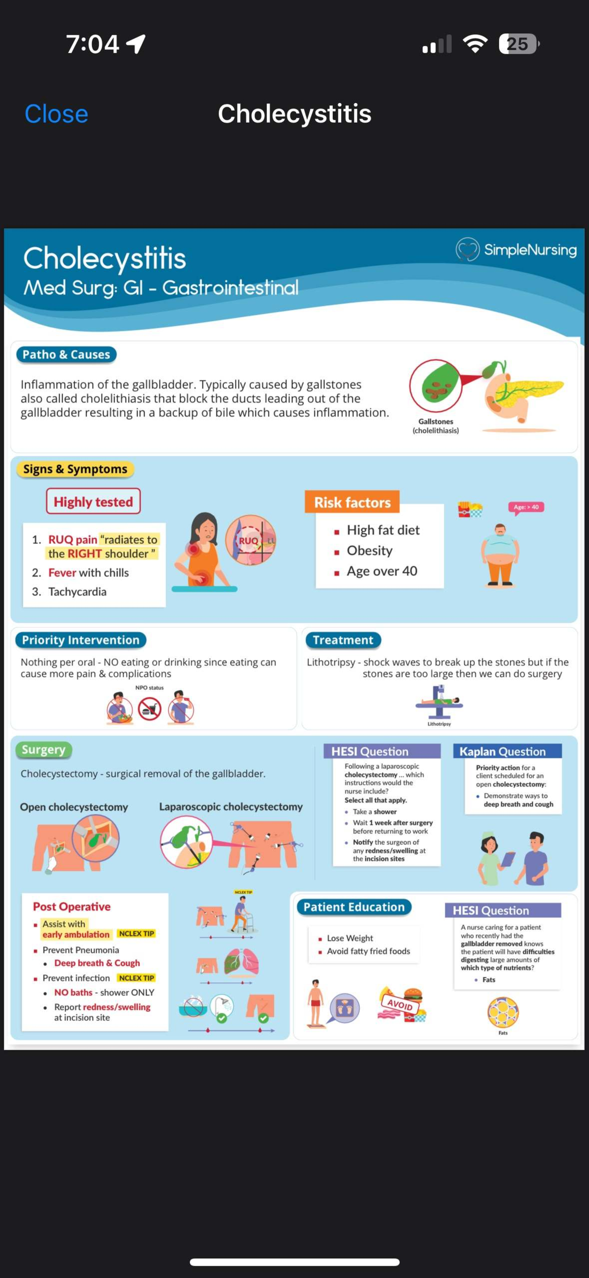 Med Surg: GI - Cholecystitis Study Guide & Key Interventions - Studocu