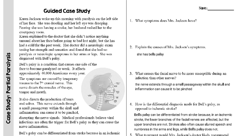 Adeline Tolpin - Guided Case Study on Bell's Palsy - Studocu