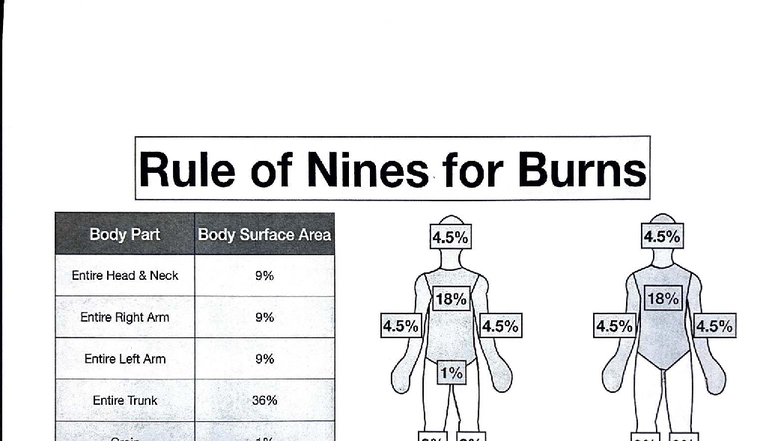 Rule of Nine-242 - Burns Doc - NUR-140 - Rule of Nines for Burns Body ...