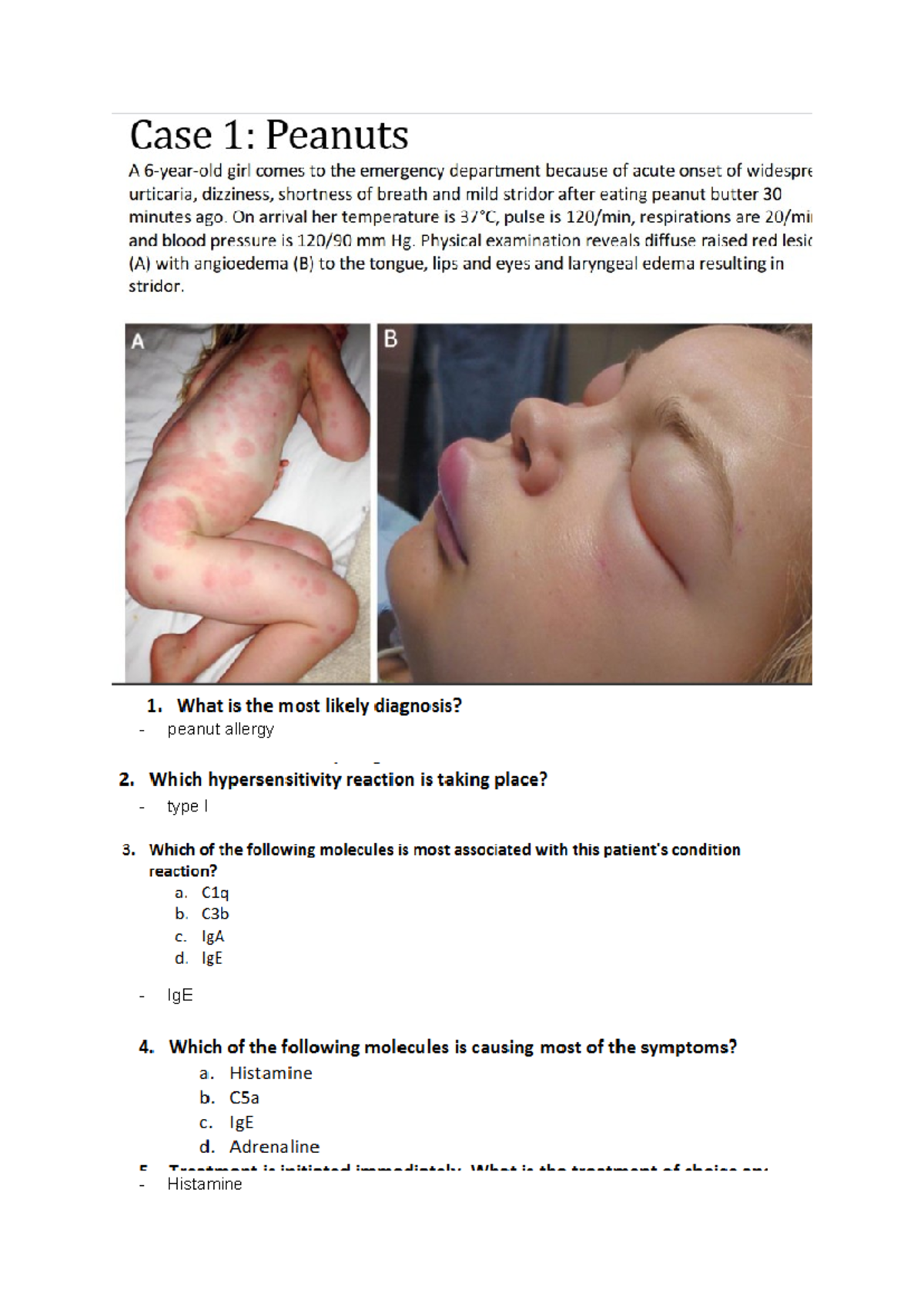 Thema 5 Werkgroep: Peanut Allergy and Type Reactions Analysis - Studeersnel