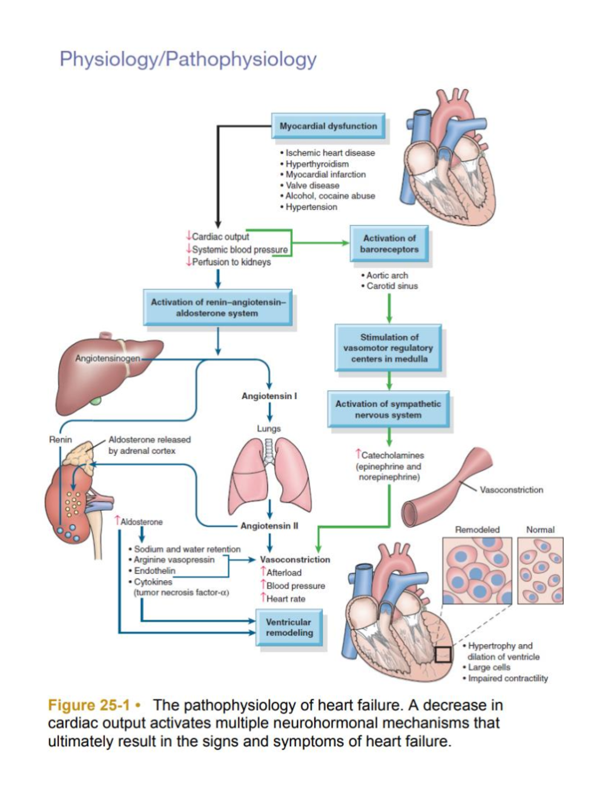 Pathophysiology of Heart Failure: Key Mechanisms and Factors - Studocu