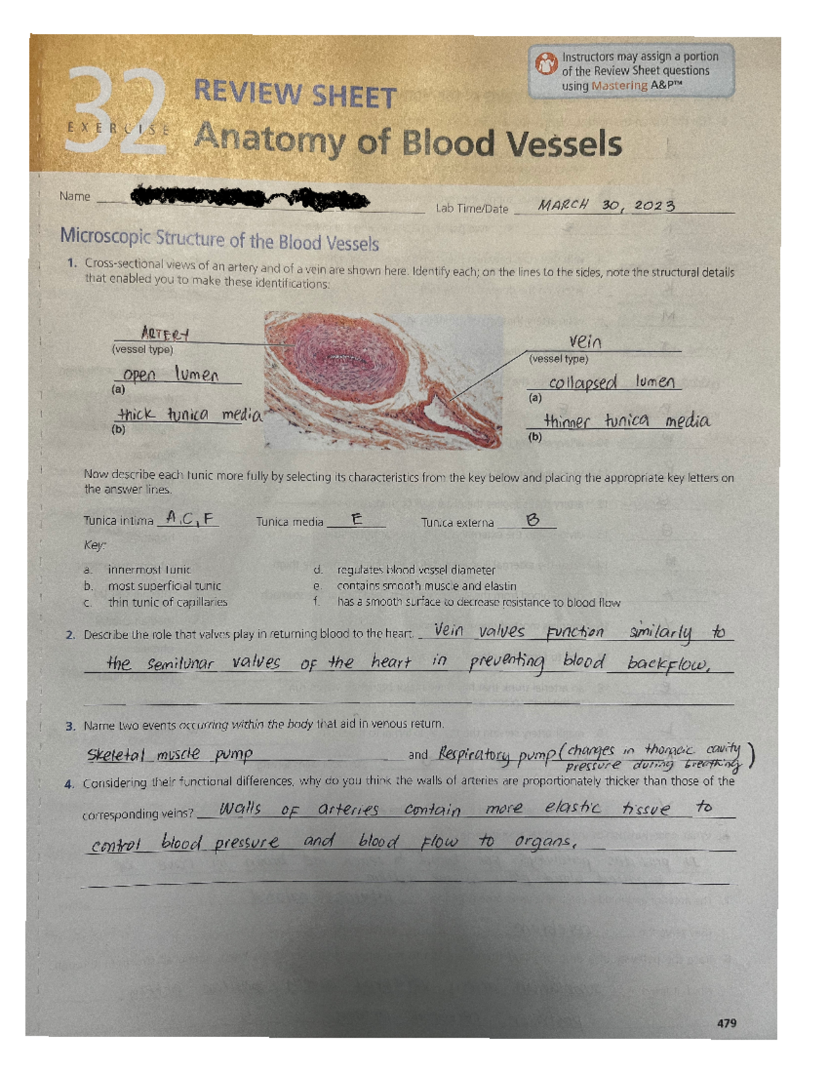Anatomy of Blood Vessels - Exercise 32 Overview - Studocu