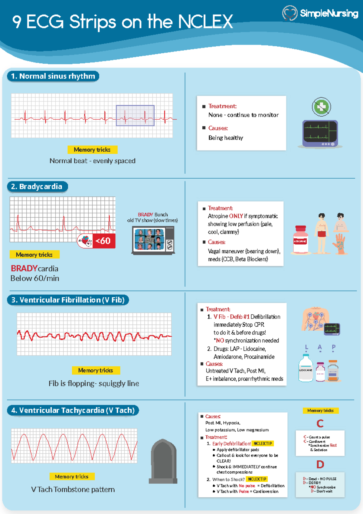 ECG Strips - Normal sinus rhythm Normal beat - evenly spaced Memory ...