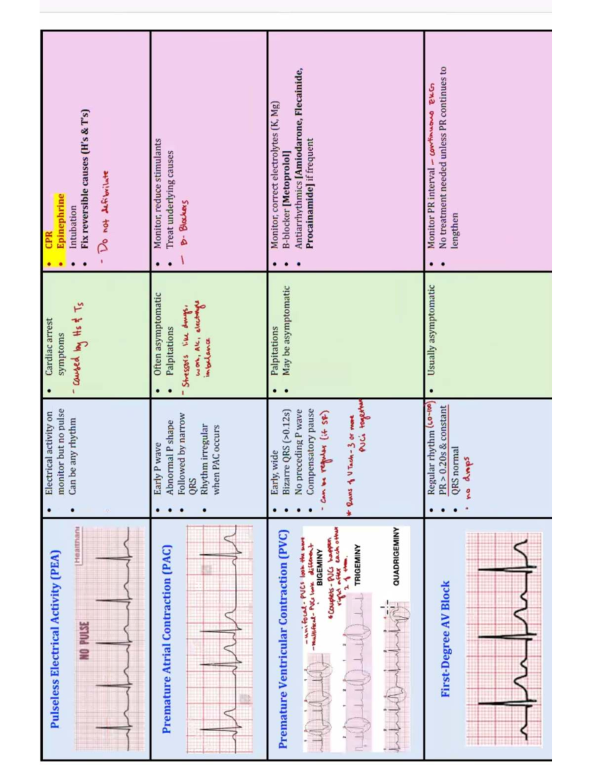 Cardiac Arrest Management: PEA, PAC, PVC, and EKG Monitoring - Studocu