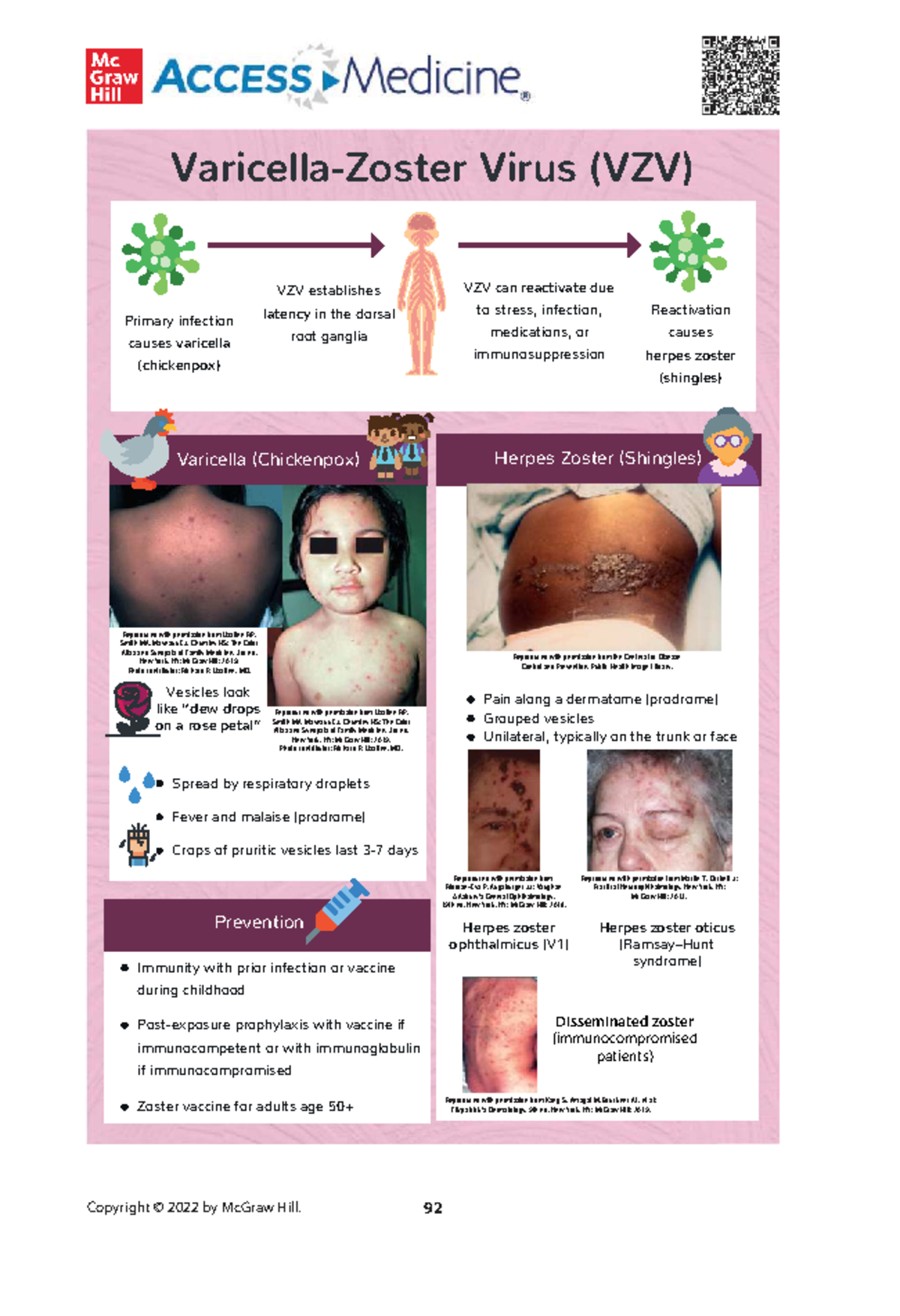 VZV Overview: Insights on Chickenpox & Shingles (Virus Study Guide ...