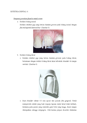 Prostodonti 11 - PROSTODONTI 11 Sebutkan dan jelaskan apa saja macam2 ...