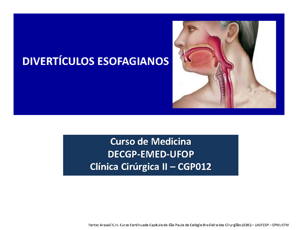 Diverticulos Esofagianos - Fonte: Arasaki C. Curso Continuado Capítulo ...