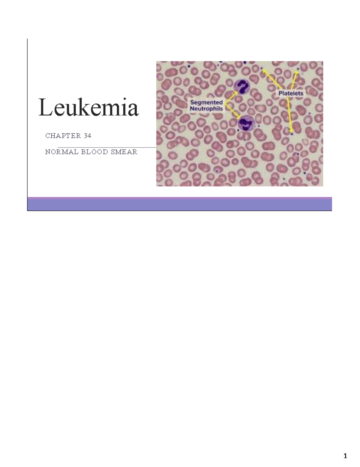 Leukemia Nursing Management & Treatment Protocols: A Comprehensive ...