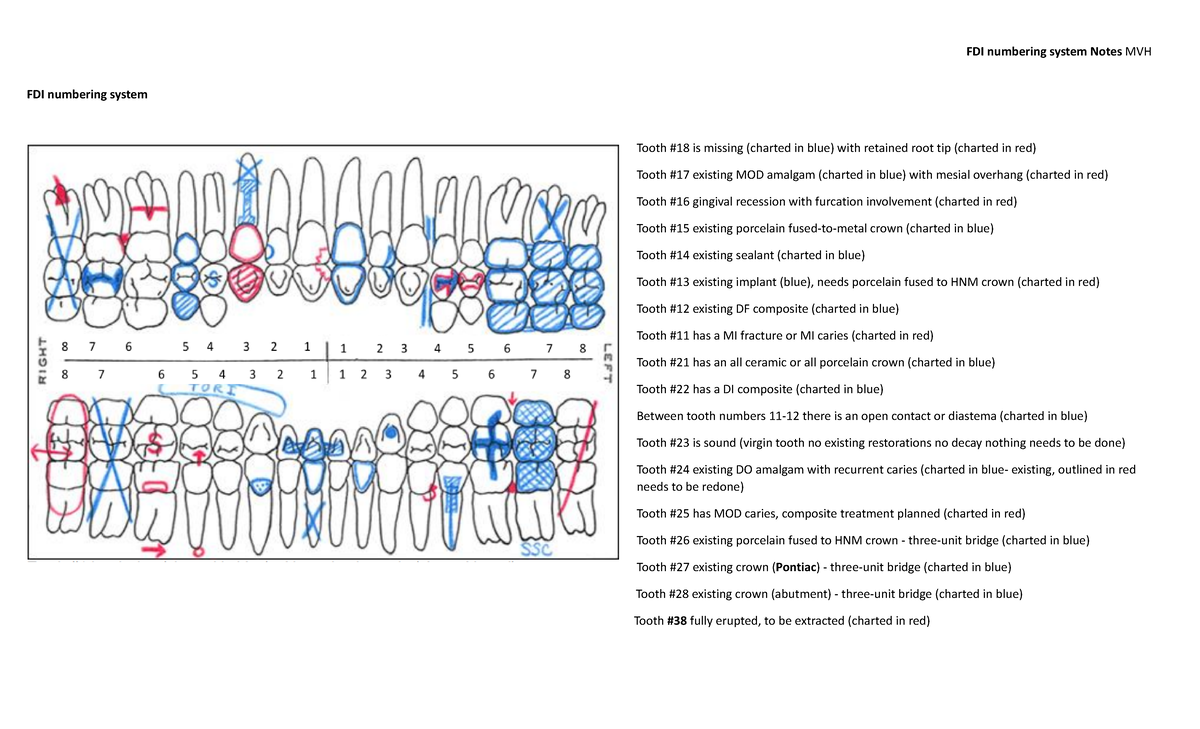 3. Charting Exercise - Summary Employment Law - FDI numbering system ...