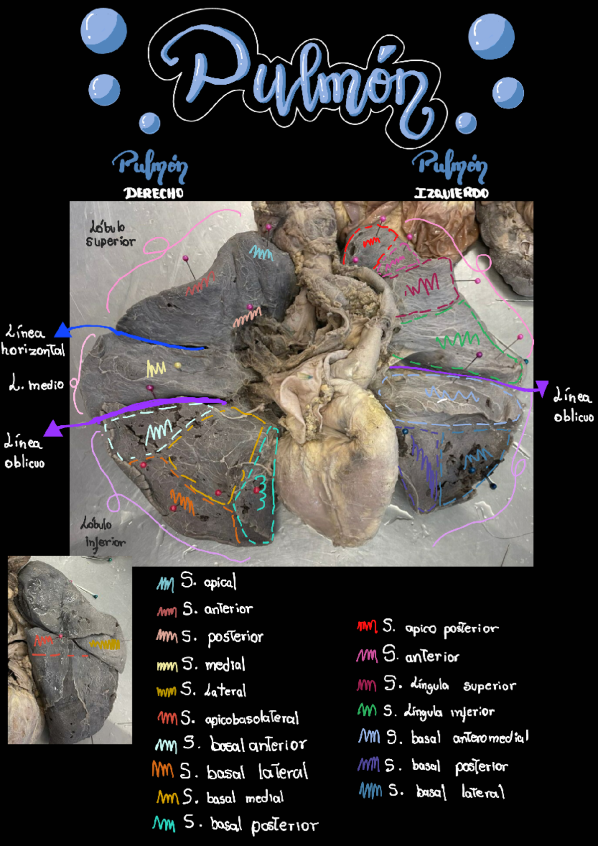 Pulmón de anatomía práctica - Pulmer Pulmon Pulyon DERECHO IZQUIERDO ...
