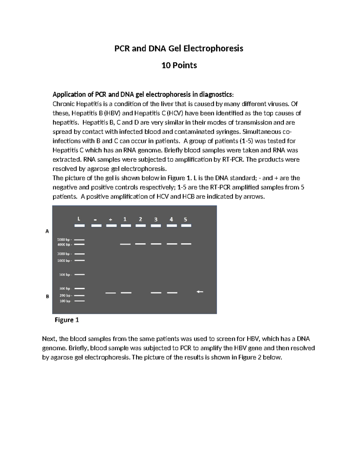 DNA Gel electrophoresis & PCR Worksheet Isaac Velasco - PCR and DNA Gel ...
