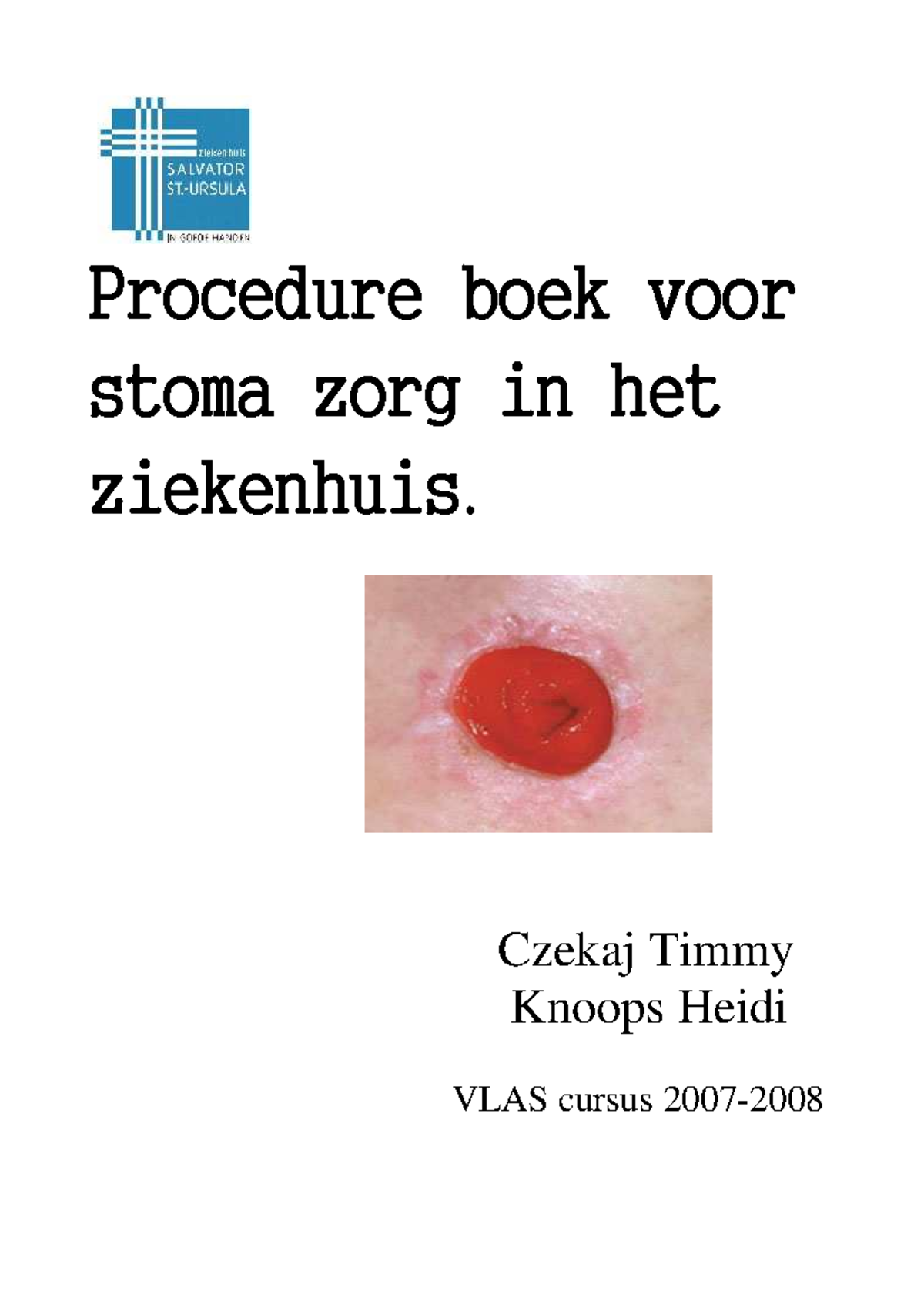 Stoma Zorg in het Ziekenhuis: Procedure en Instructies - VLAS 2007 ...