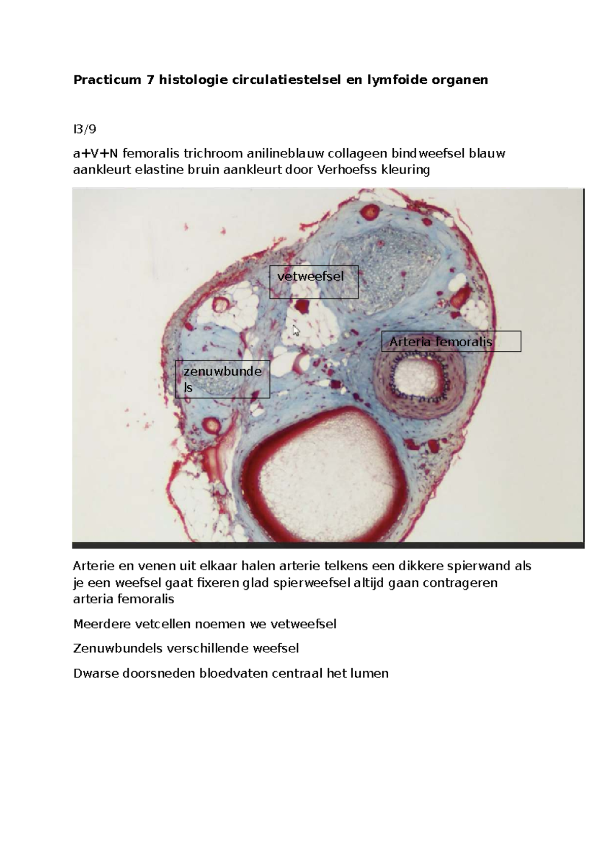 Practicum 7: Histologie van het Circulatiestelsel en Lymfoïde Organen ...