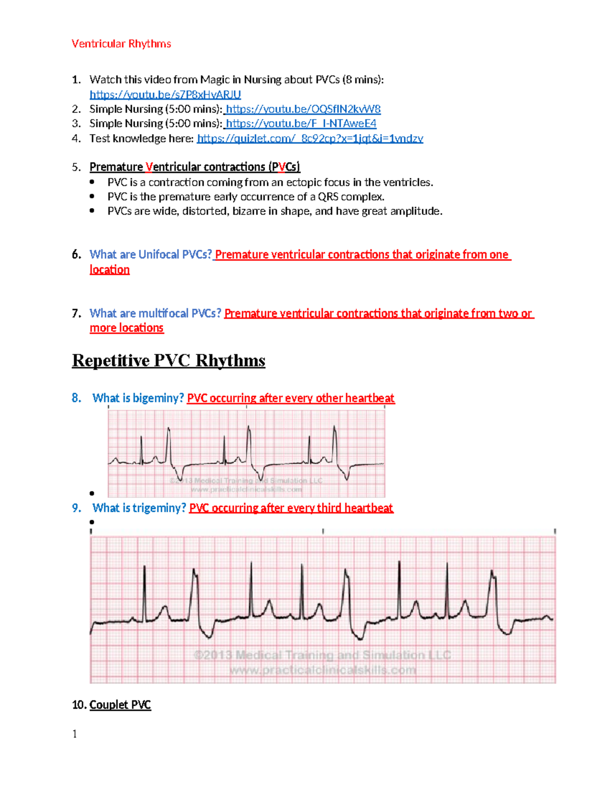 5. Ventricular Rhythms student - Watch this video from Magic in Nursing ...